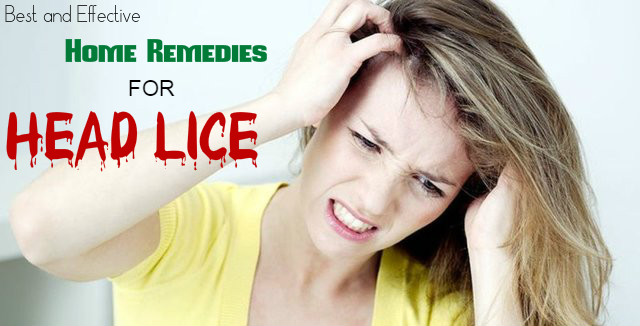 Best And Effective Home Remedies For Head Lice Stylish Walks